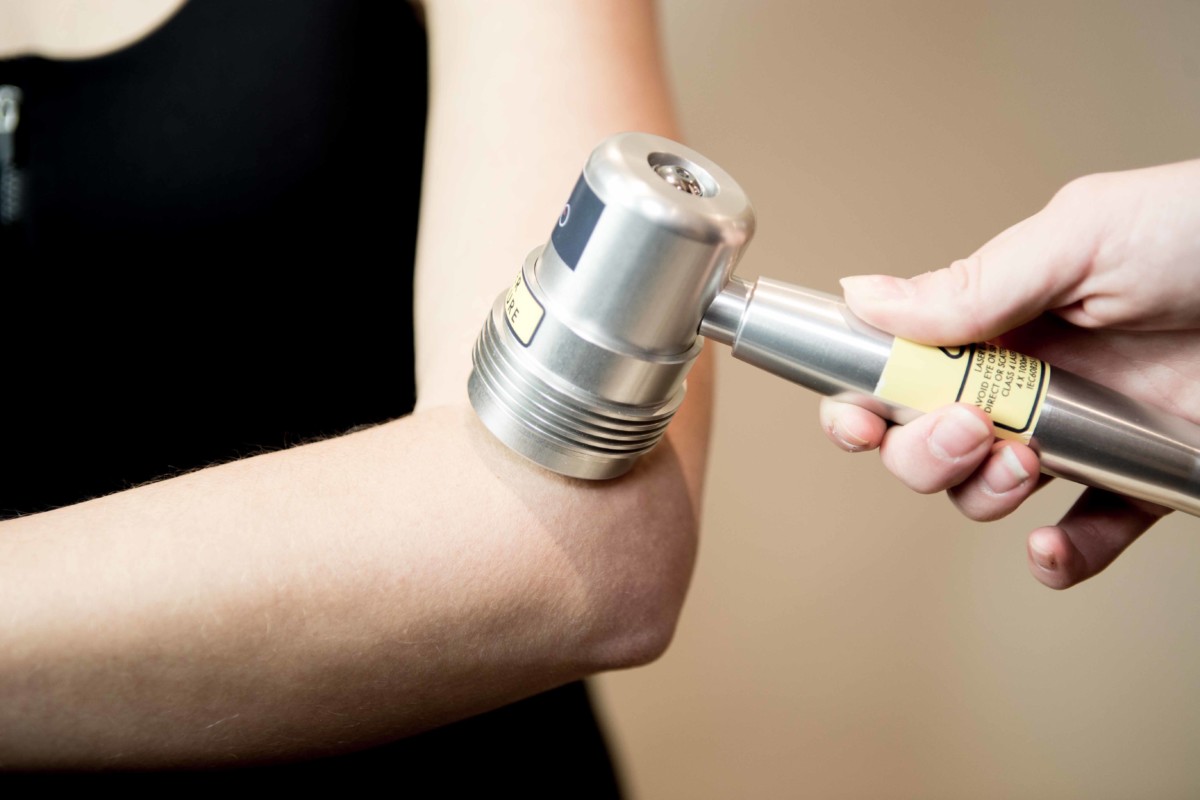 Tennis Elbow Laser Therapy | Simply Align Rehab